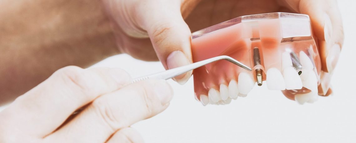 Periodontology – EADPH e.V.